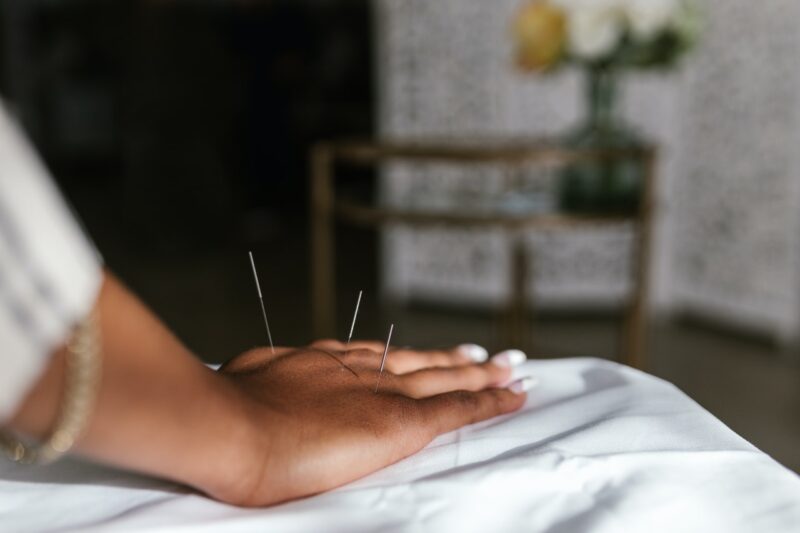 Akupunktur, Jenis dan Apa Manfaatnya Buat Kesehatan | GOODLIFE